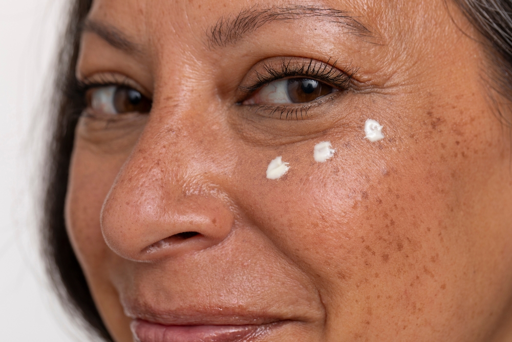 Do Eye Creams Really Work? Insights from Dr. Soheila Rostami